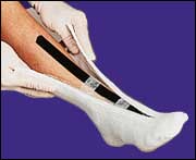 Construction of a Foot Mold - STS Company